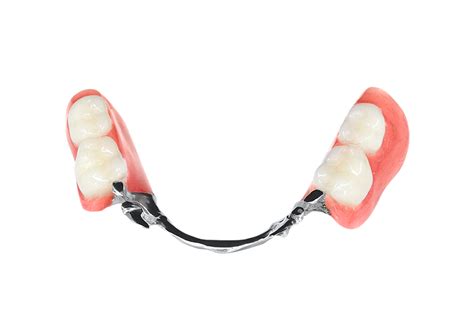 What Is A Mandibular Partial Denture At Daniel Gilmore Blog What Is A Mandibular Partial Denture At Daniel Gilmore Blog