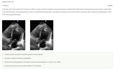 The Echo Board Exam Everything You Need To Know To Pass • Myheart