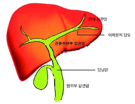 Classifications Of Cholangiocarcinoma According To The Anatomical Location Download