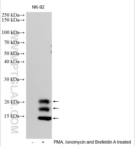 Gm Csf Antibody 30349 1 Ap Proteintech