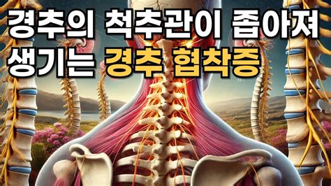 해답은 자세를 펴는 것 경추의 척추관이 좁아져 생기는 경추 협착증 Youtube