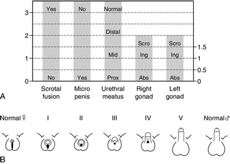 21 Disorders Of Puberty And Sex Development Basicmedical Key