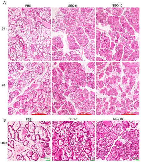 Toxins Special Issue Staphylococcus Aureus Toxins