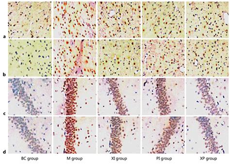 Expression Of C Fos And C Jun Proteins In The Cortex And Hippocampus A