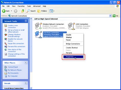 Dhcp Settings For Windows Xp