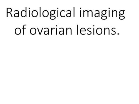 Ovarian Mass Evaluation In Radiology Pptx