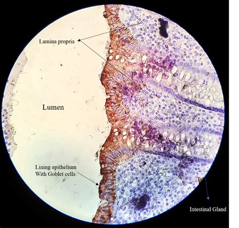 Bethlehem University Integrates Histopathology Into Medical Lab Sciences Bethlehem University