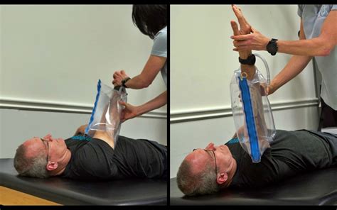 Hand And Arm Exercises For Stroke Patients At Bryan Northern Blog