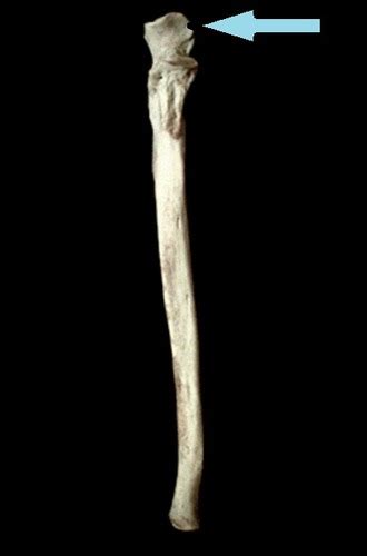 Ulna Flashcards Quizlet