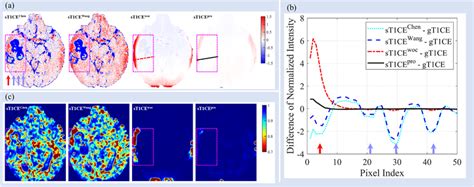 difference images a and structural similarity index measurement