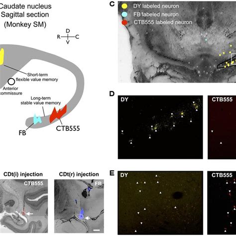 Retrograde Tracer Injections In Two Functional Domains Of Cd A Side Download Scientific