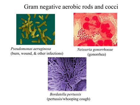 Ppt Taxonomy And Classification Of Microbes Especially Prokaryotes
