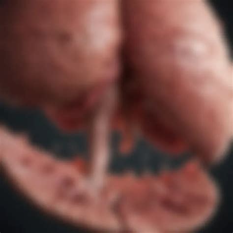 Cirrhosis Liver Cancer And Survival Rates Explored