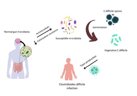 Gut Microbiota And Clostridioides Difficile Infection Cdi Download
