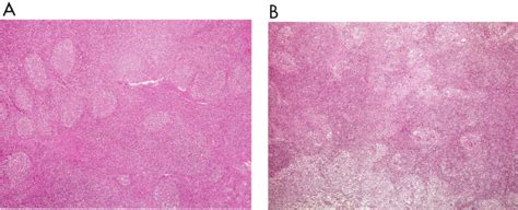 A Histological Pattern Of A Superficial Inguinal Lymph Node Of A
