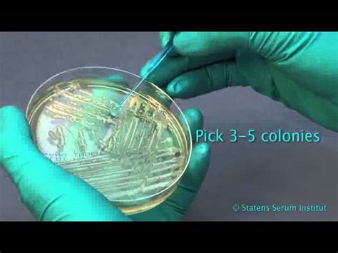 Точные тесты на сальмонеллез: быстрые и надежные лабораторные анализы