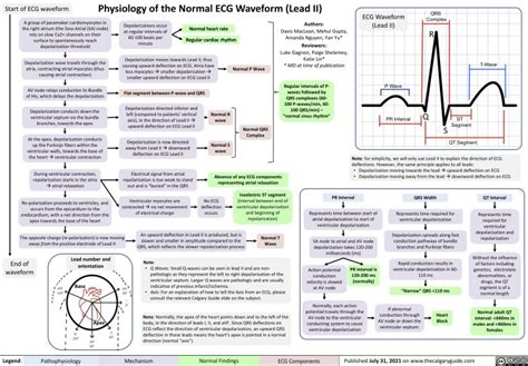 Physiology Of The Normal Ecg Waveform Lead Ii Calgary Guidecalgary
