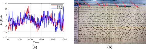 Figure 1 From The Effect Of Coupled Electroencephalography Signals In