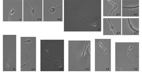 morphological classification of mouse epididymal sperm phase contrast