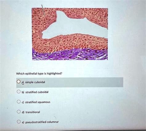 Which Epithelial Type Is Highlighted A Simple Cuboidal B Stratified Cuboidal C Stratified