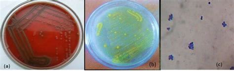 Staphylococcus Hominis An Overview Microbe Notes