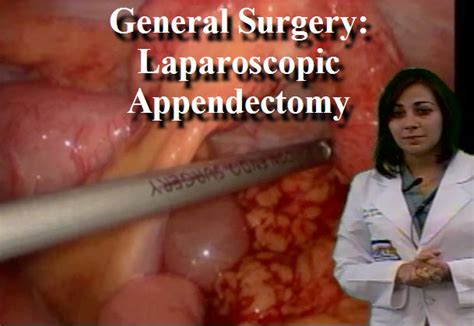 Surgical Subspecialties Laparoscopic Appendectomy For Residents Anatomy Guy