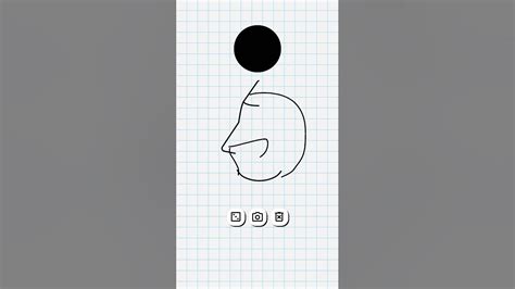 Hyperpigmentation Drawing Youtube