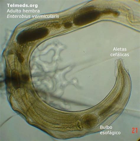 Enterobius Vermicularis Adulto Hembra Nematodos Ciencias De La
