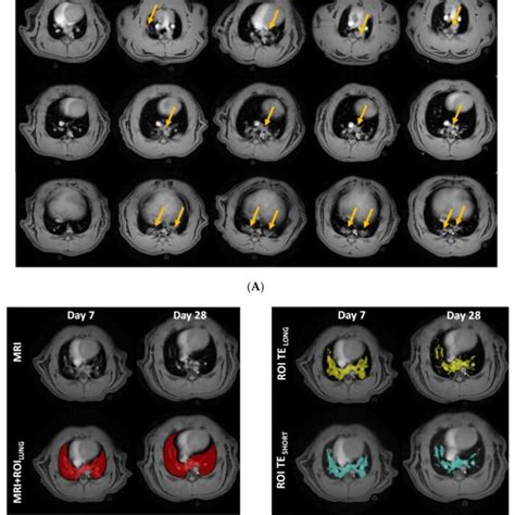 Longitudinal Magnetic Resonance Imaging Mri In Group I During 28