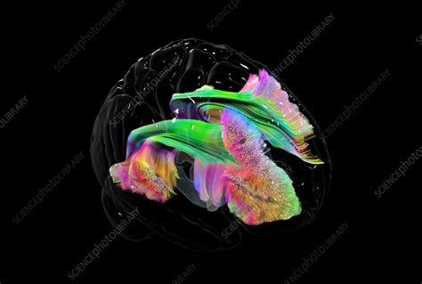 Arcuate Fasciculus Dti Mri Scan Stock Image C0581604 Science