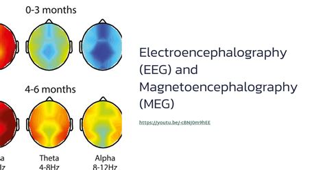 Electroencephalography Eeg And Magnetoencephalography Meg