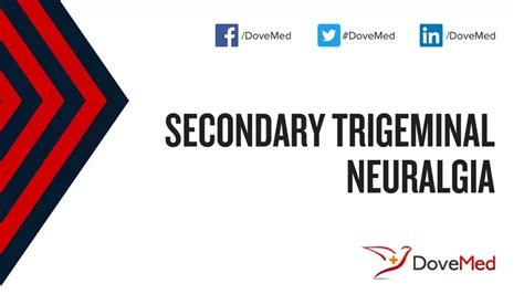 Secondary Trigeminal Neuralgia Dovemed