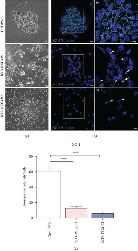 Morphological Features Of Ctrl And Rtd Ipscs A Phase Contrast Images