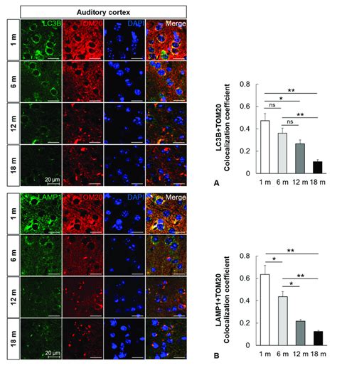 Impairment Of Mitophagy In The Mouse Auditory Cortex With Aging A