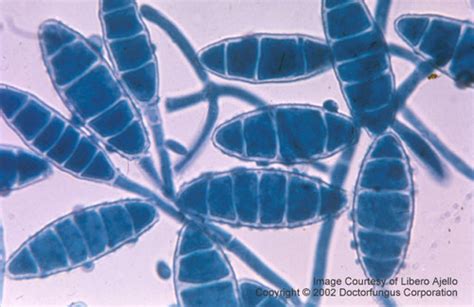 Mycology Flashcards Quizlet