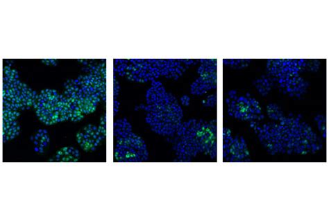 CDK Antibody Sampler Kit Cell Signaling Technology