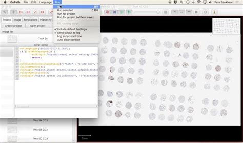 Tma Cd3 Analysis · Qupath Qupath Wiki · Github