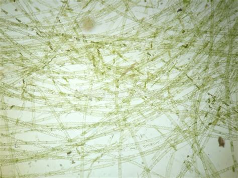 Filamentous Algae Stock Image Image Of Healthcare Aquaculture 89484919