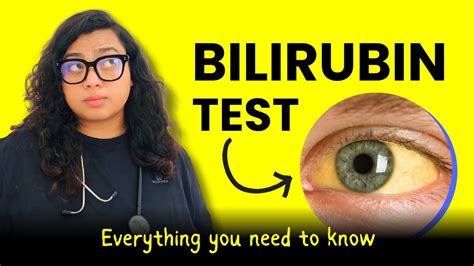 What Is Bilirubin Test How Its Done High Low Values And Treatment