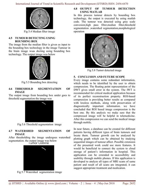 Implementation Of Brain Tumor Extraction Application From Mri Image Pdf