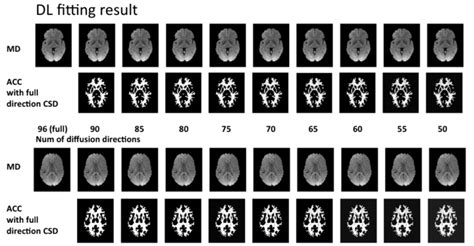 Robust Fiber Orientation Distribution Function Estimation Using Deep