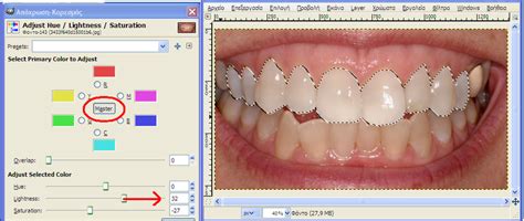 Using The GIMP Image Editing Software To Visualize The Outcome Of Teeth Download Scientific