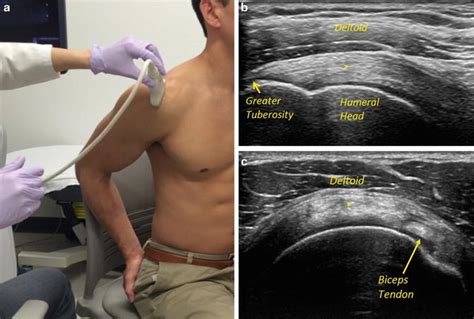 Ultrasound Shoulder Position Ultrasound Shoulder Scan Yinsbk