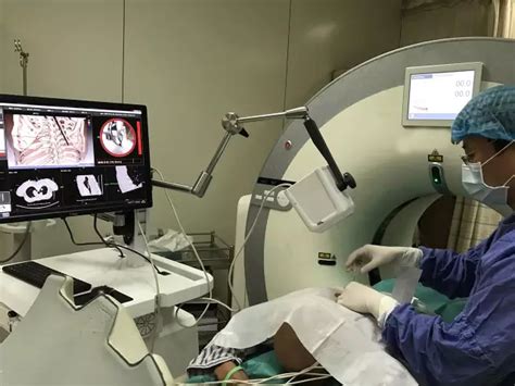 机器视觉在医学影像应用 上海华墉医疗科技有限公司 Shanghai Huayong Medical Technology Coltd