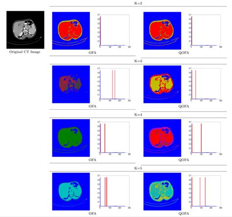Multilevel Thresholding Segmentation Results Obtained From Ofa And Ofa