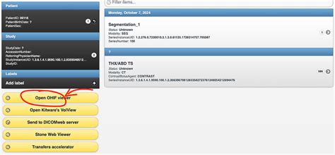 displaying dicom images and corresponding dicom seg segmentations in