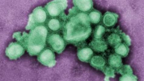 Public Health Reports First Pediatric Flu Deaths Of The 2024 25 Flu