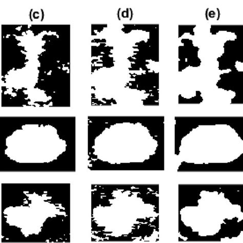 Comparison Of Segmentation Using A Ground Truth Manual Delineation Download Scientific