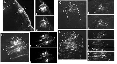 Dml Cell Displacement And Elongation In The Stul Zone Of The Myotome