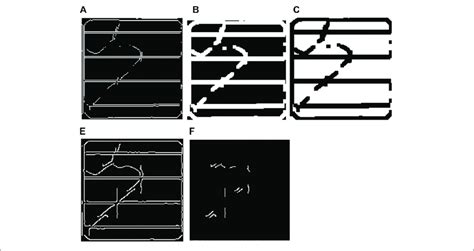 Detection Effect Diagram Of The Algorithm In This Article Download